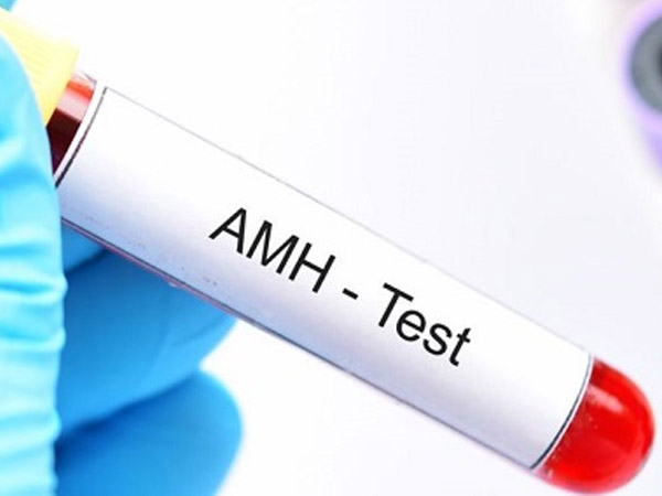 Ý nghĩa xét nghiệm AMH? Những ai nên làm xét nghiệm AMH ? - Invivo Lab
